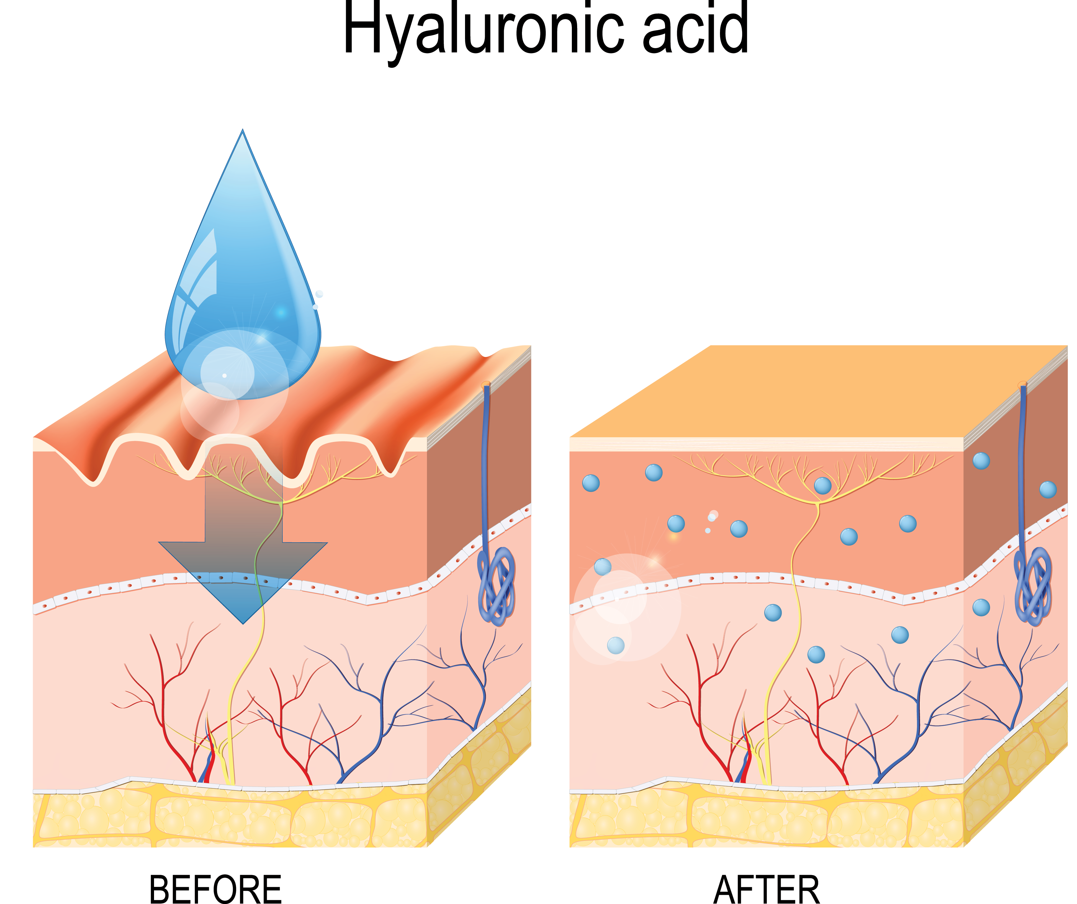 What is Hyaluronic Acid? – PROBEAUTY Group